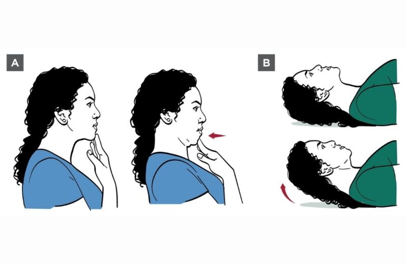 3 Exercises Thatll Help You Get Rid Of Forward Neck Posture Text Neck