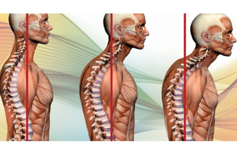 7 Exercises That’ll Help Get Rid of Dowager’s Hump