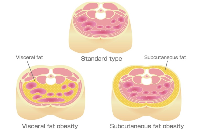 3 Simple Steps to Reduce Visceral Fat, Backed by Science
