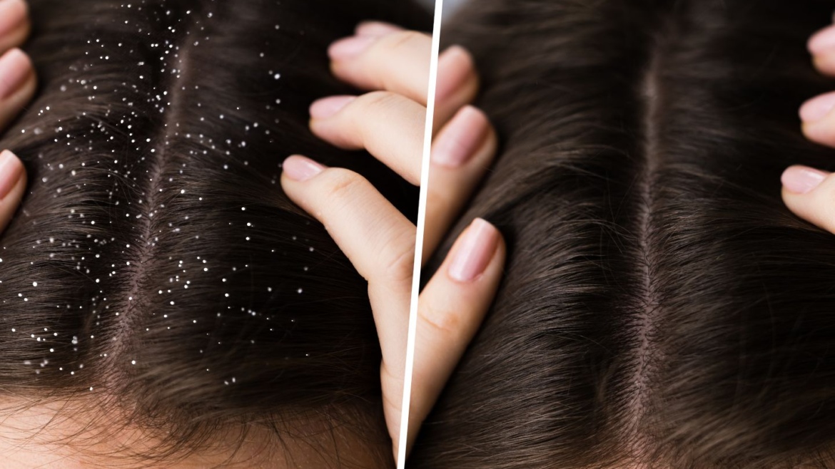 Rapid Arm Transformation: Unveiling a 15-Minute Dumbbell Workout for ...